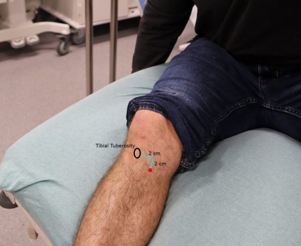 Intraosseous Line - Emergency Medicine Training